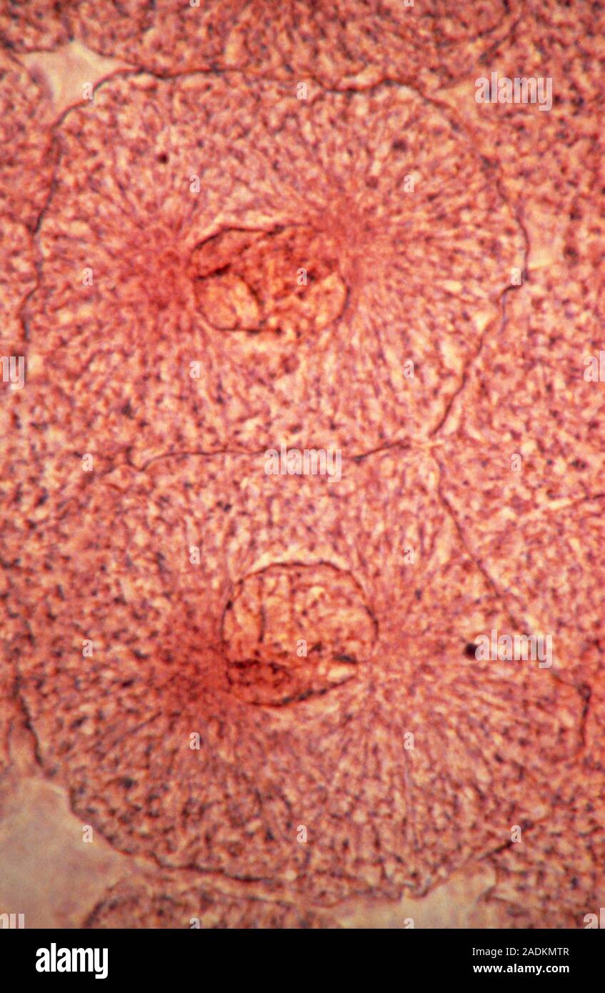 Light micrograph showing the results of mitosis (cell division) in a ...