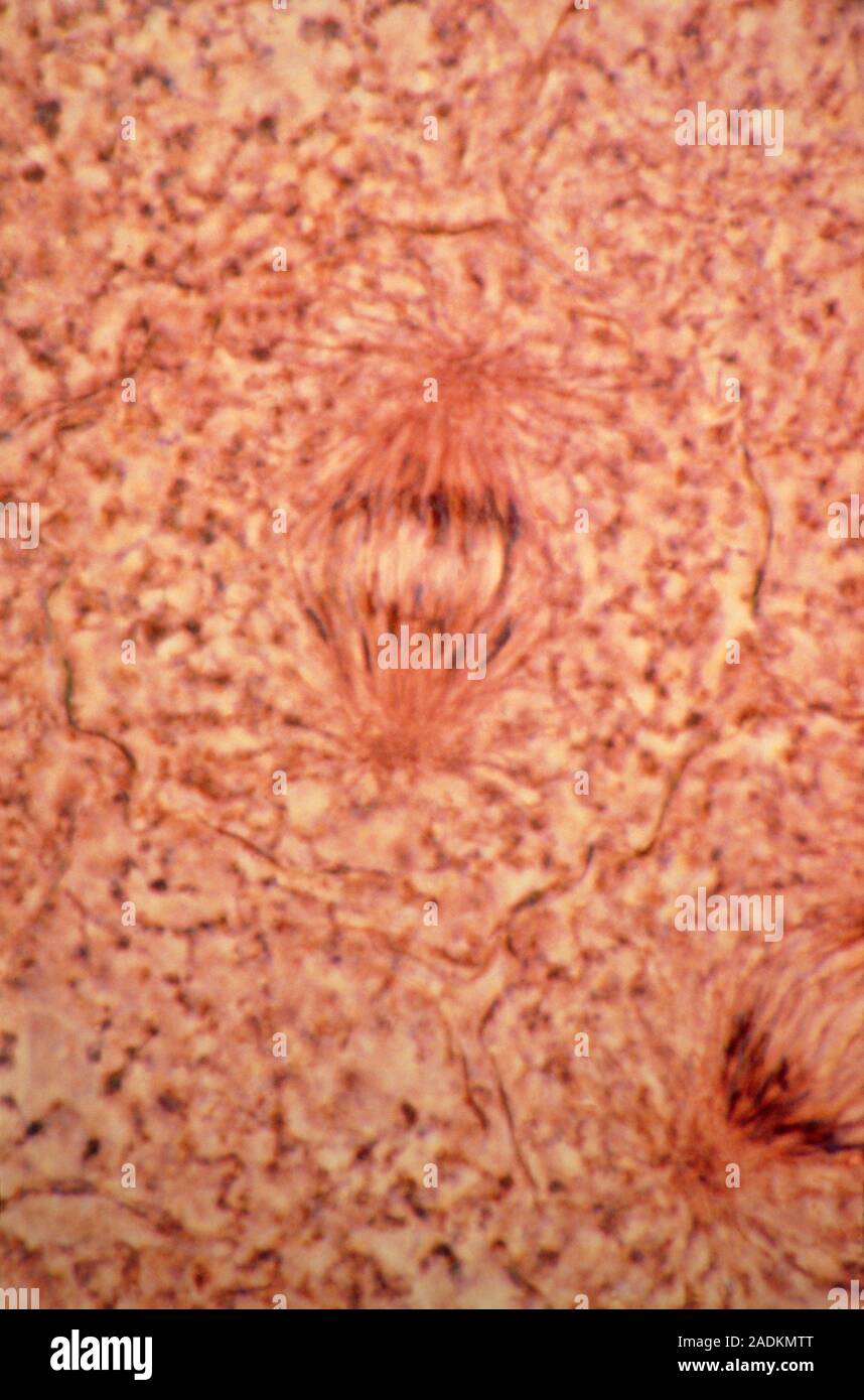 Light micrograph showing mitosis (cell division) in a whitefish cell ...