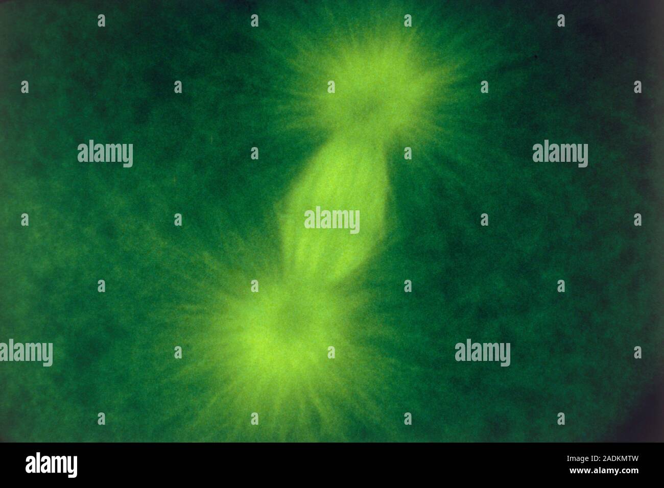 Immunofluorescent micrograph of microtubules (spindles) comprising the ...