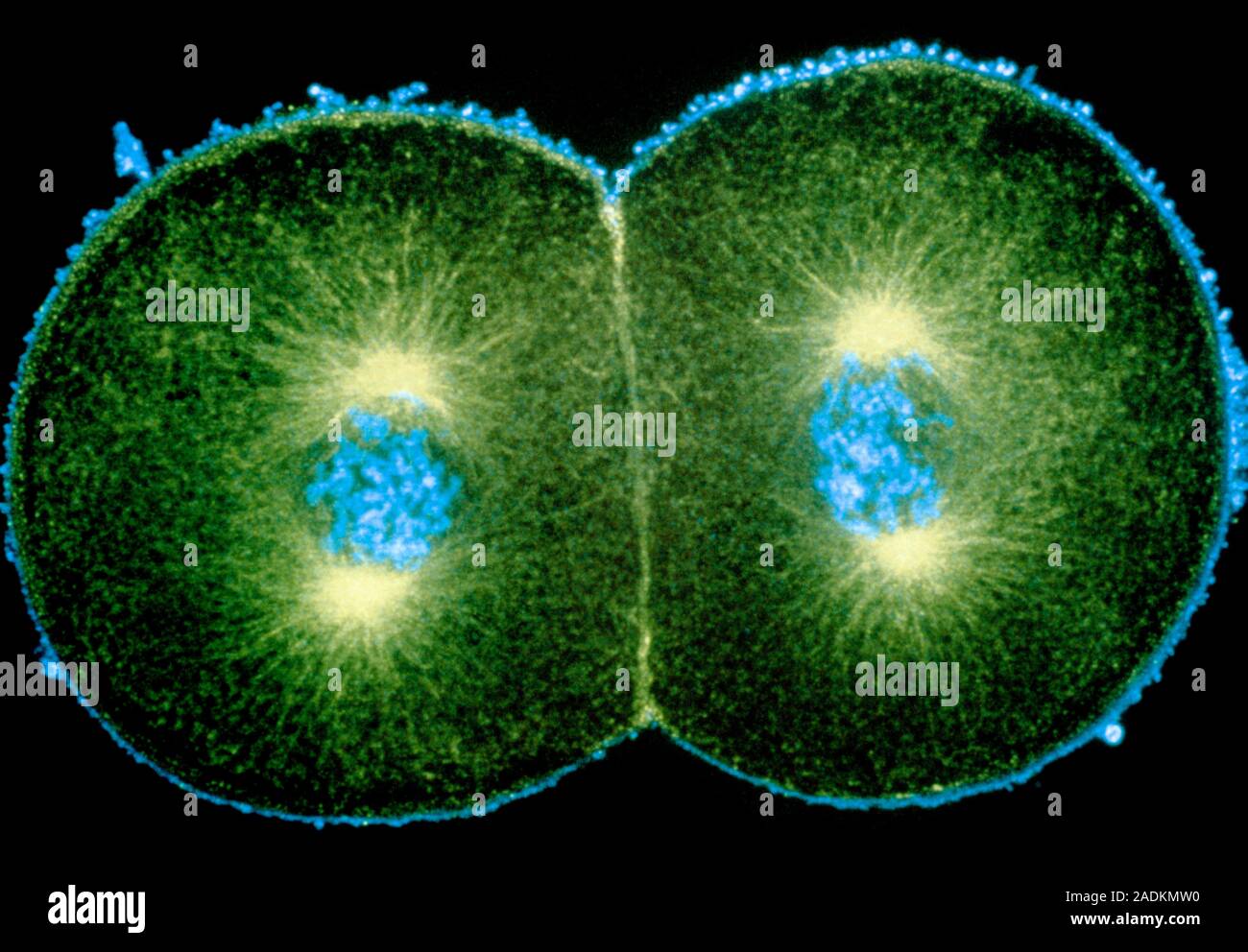 Mitosis. Immunofluorescence micrograph of a newly fertilized sea urchin ...