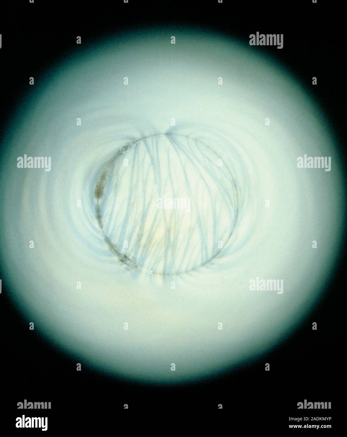 Endoscopic image of a human foetus in vivo,5 minutes before birth ...