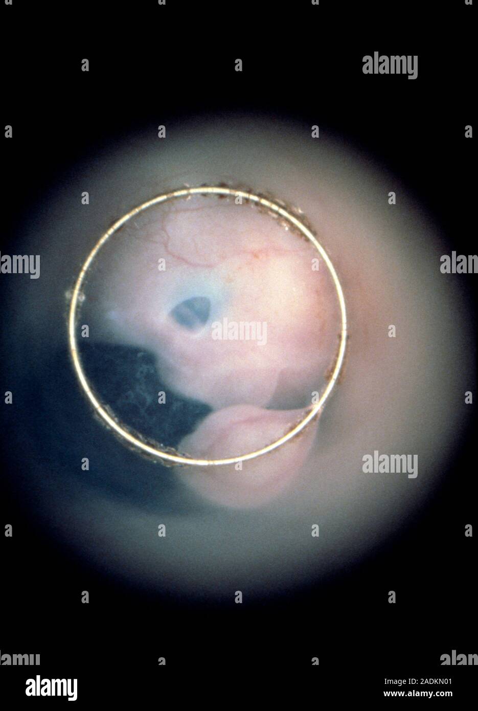 Endoscopic image of the human embryo in vivo, after 7 weeks, showing ...