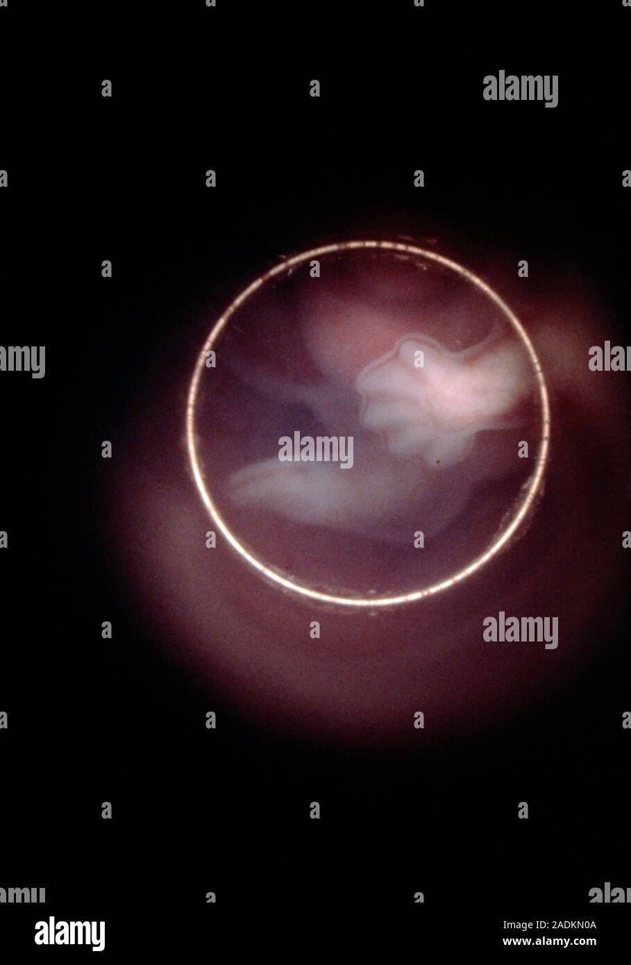 Endoscopic image of the human embryo in vivo, after 5 weeks, showing ...