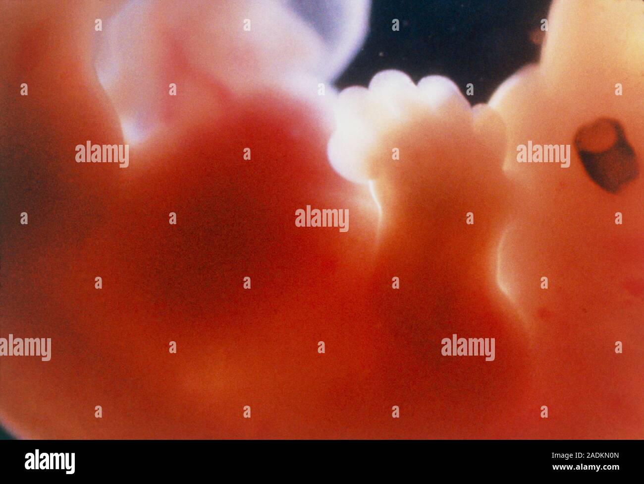 The human embryo at about 7-8 weeks, showing the head (right) with the ...