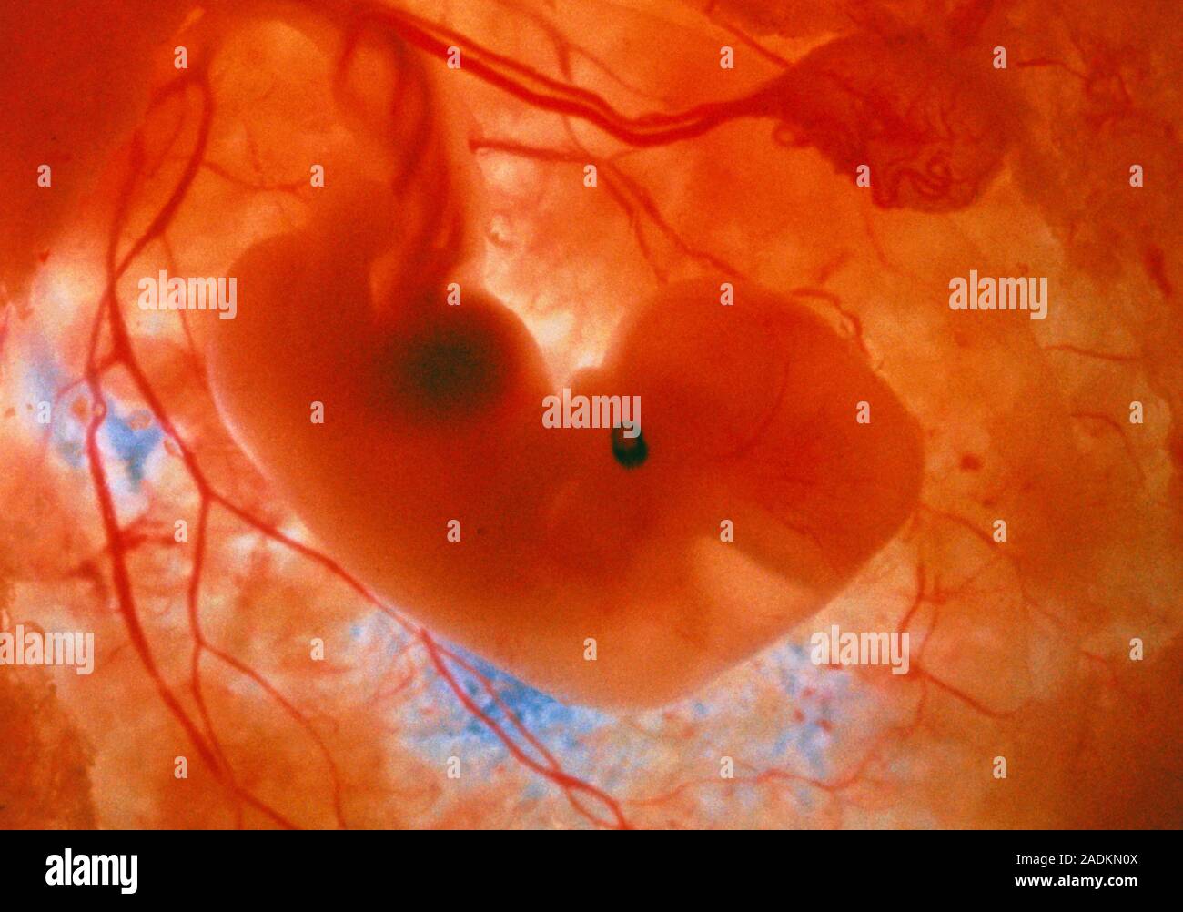 The human embryo at around 7 weeks, surrounded by the membranes of the ...