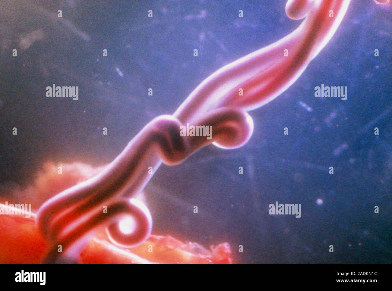 The human foetus during the 12th week, showing the umbilical cord ...