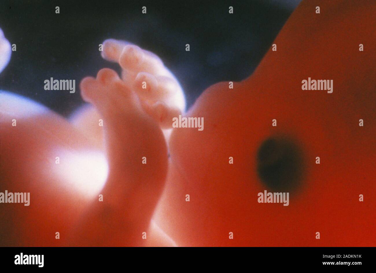 The human foetus aged 10 weeks, showing the head, arms & hands. After 8 ...