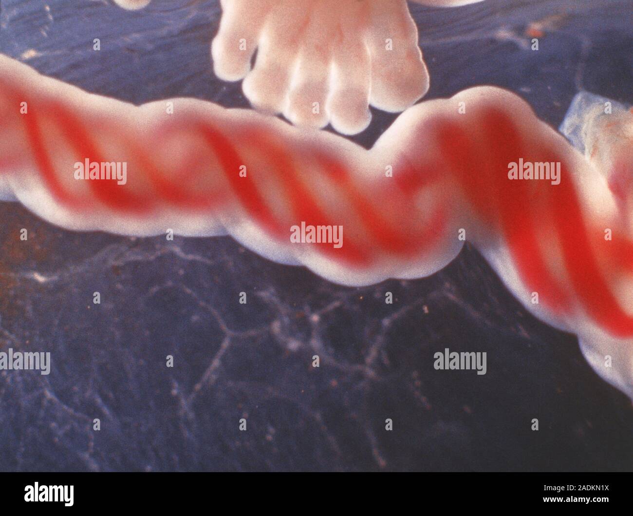 The umbilical cord of an 8-10 week human foetus, the strand of tissue ...