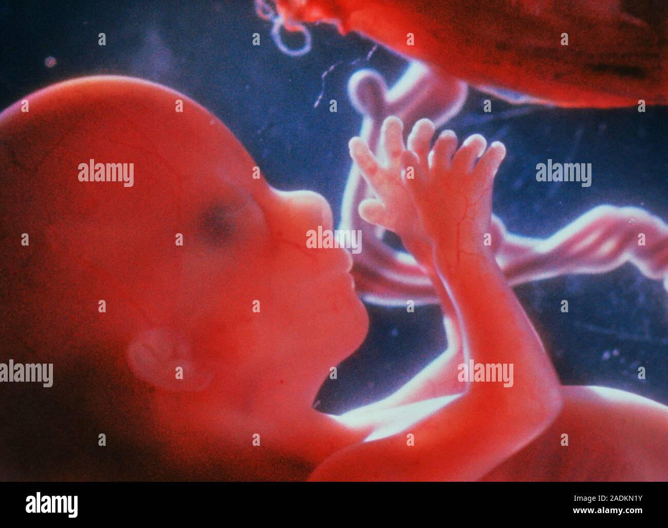 The human foetus at about 12 weeks showing the head and upper limbs and ...
