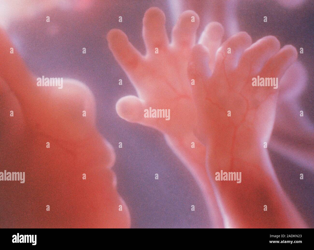 The human foetus after 20 weeks showing the degree of development of ...