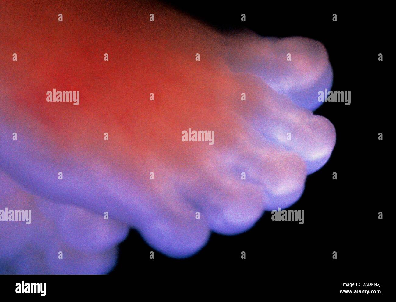 The human foetus after 4-5 months (17-22 weeks), showing the extent of ...