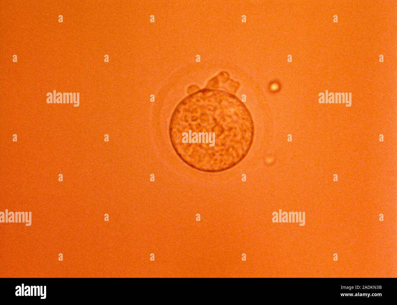 Light micrograph of a human zygote (the primitive embryo) at the single ...