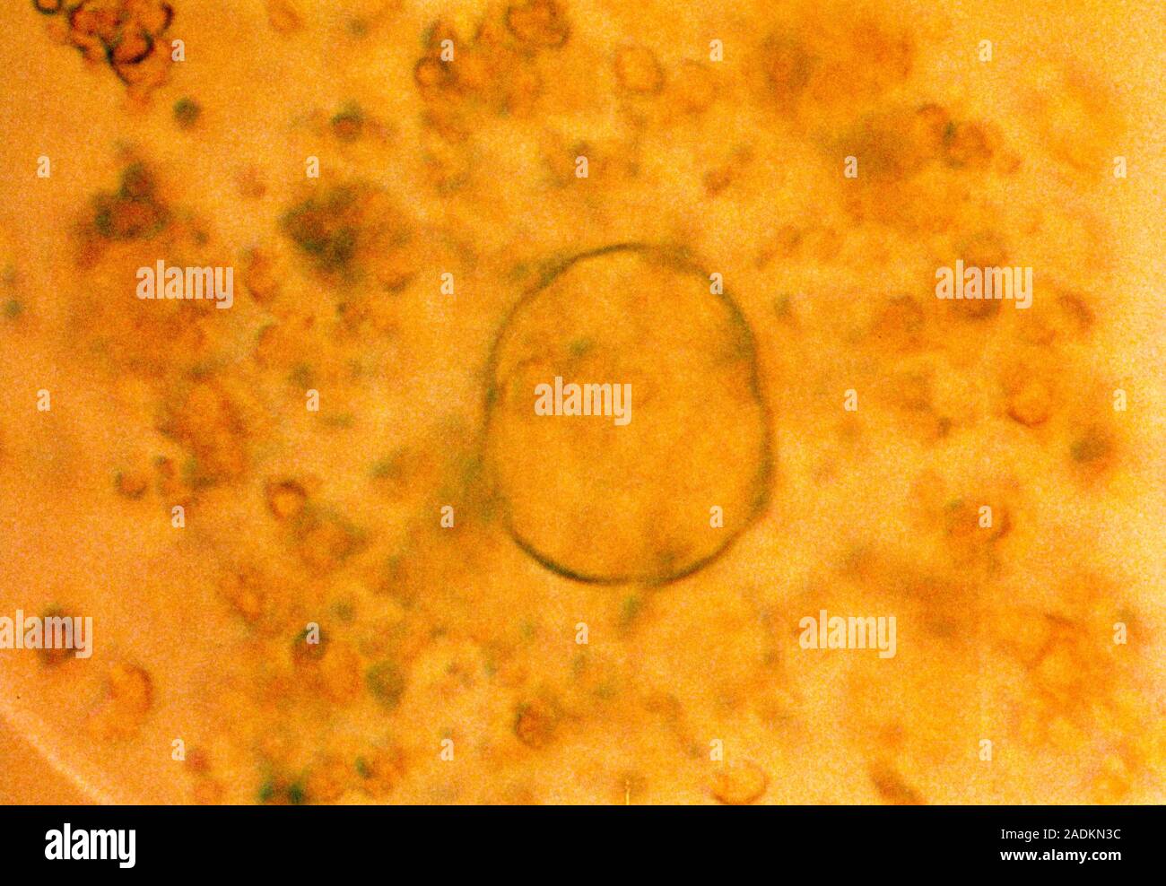 Light micrograph of a human zygote (the primitive embryo) in the ...