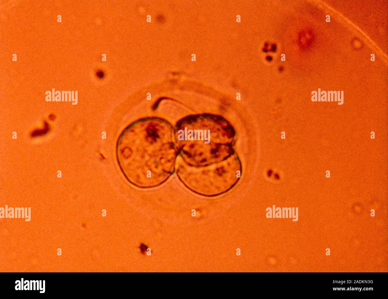 Light micrograph of a human zygote (the primitive embryo) at the three ...