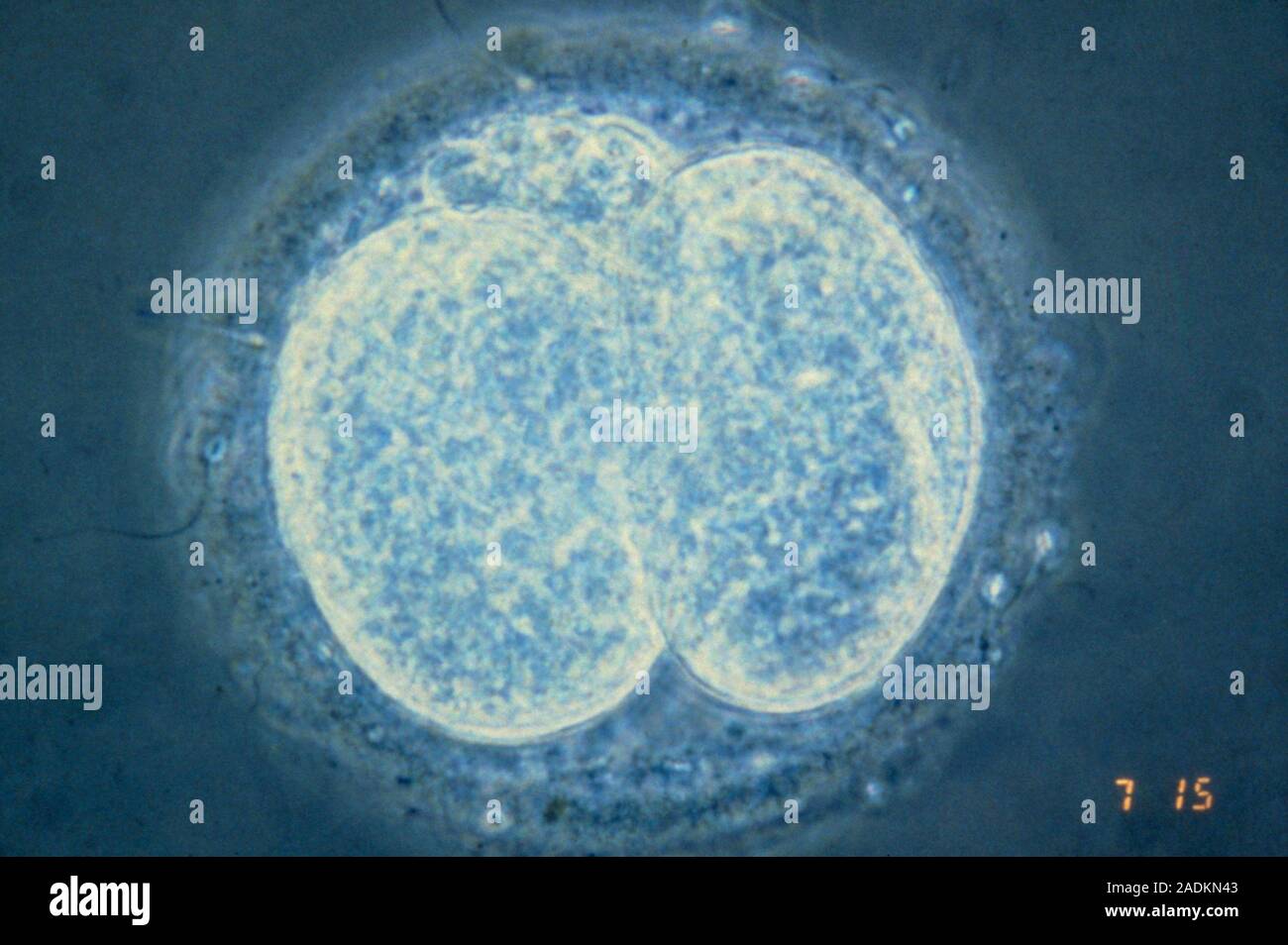 Light micrograph of a human zygote (the primitive embryo), composed of ...