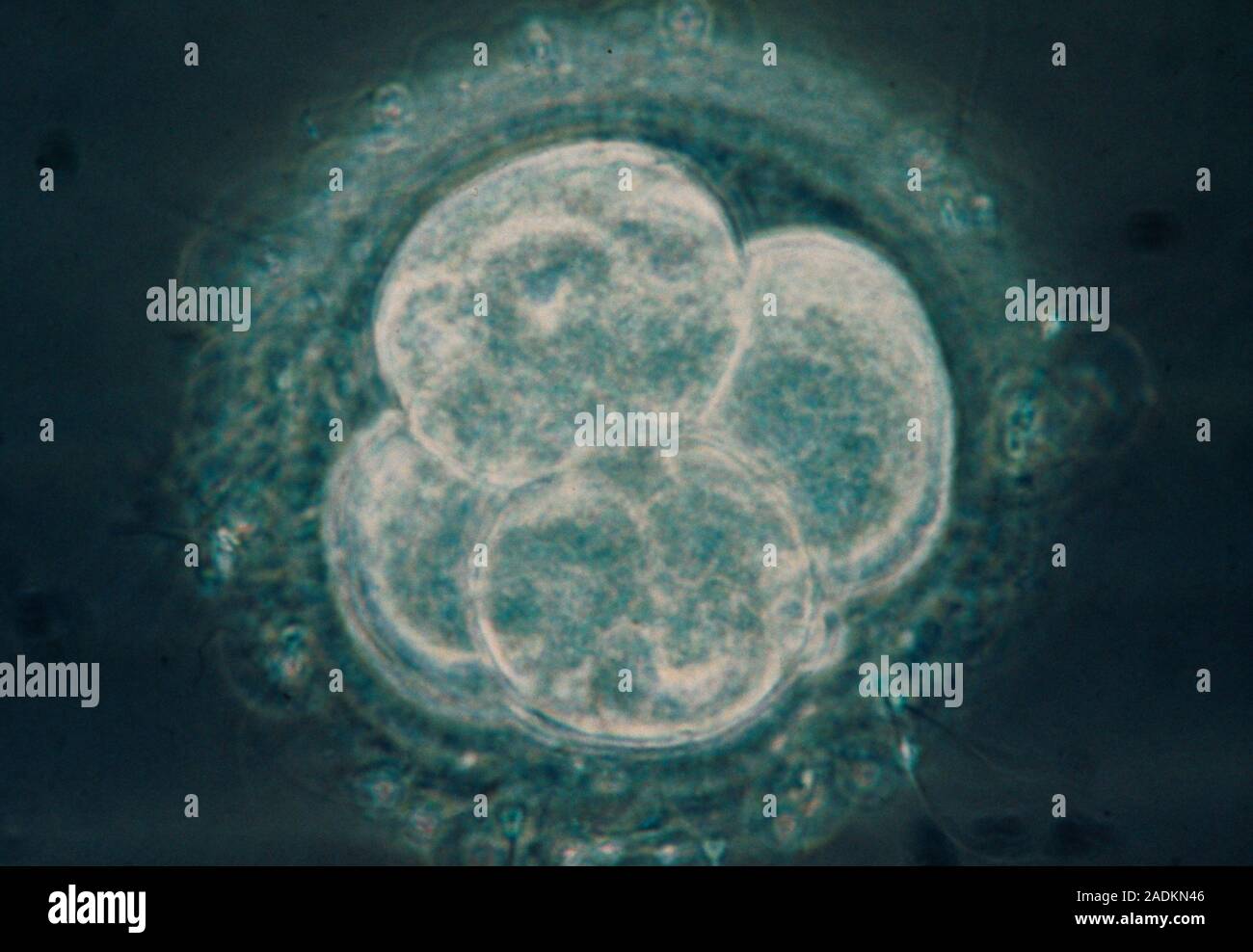 Light micrograph (phase contrast) of a primitive human embryo, composed ...