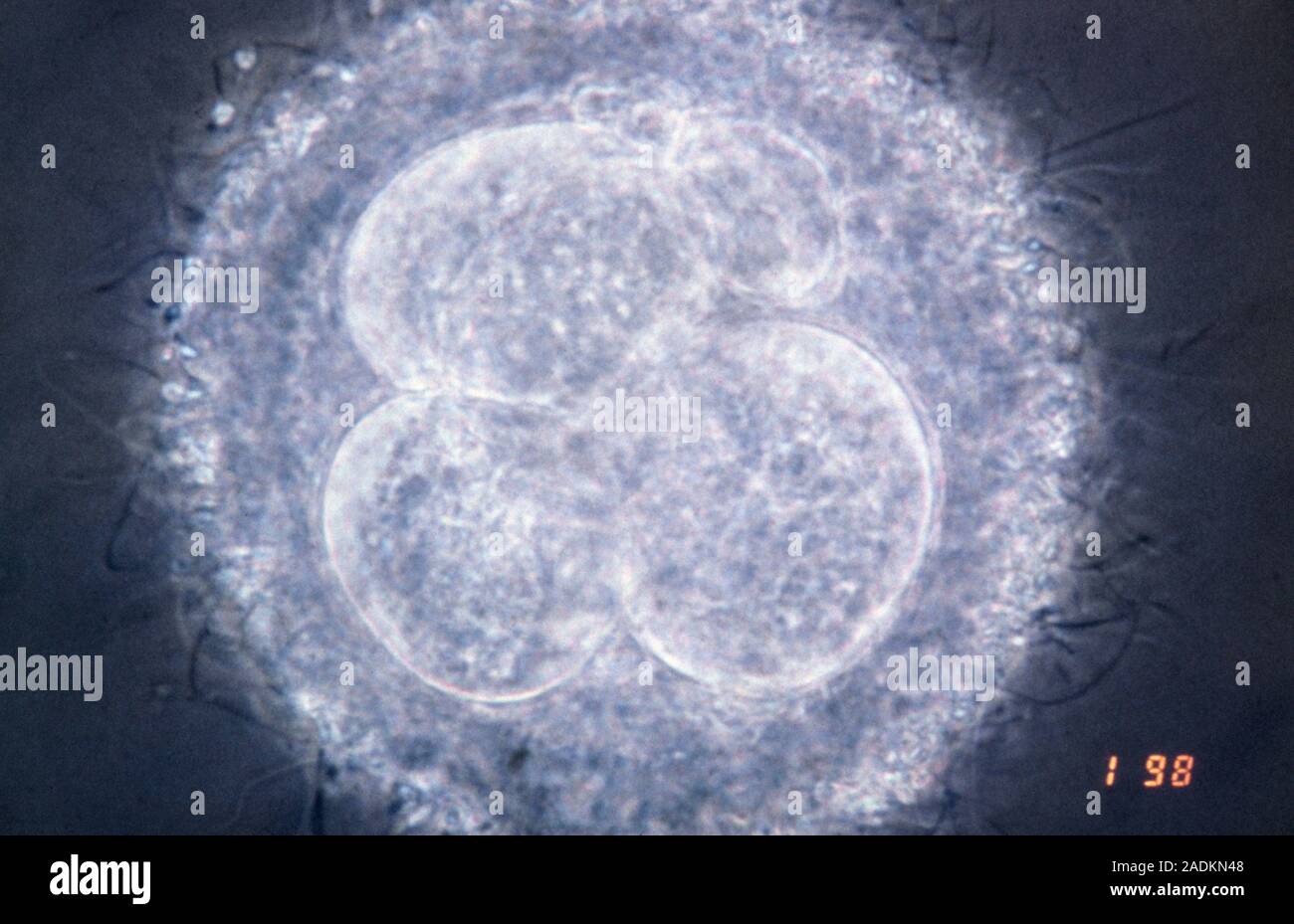 Light micrograph of a primitive human embryo, composed of four cells ...
