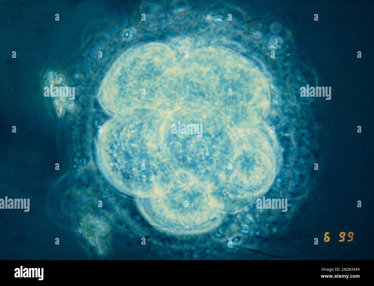 Light micrograph of a primitive human embryo, composed of eight cells ...