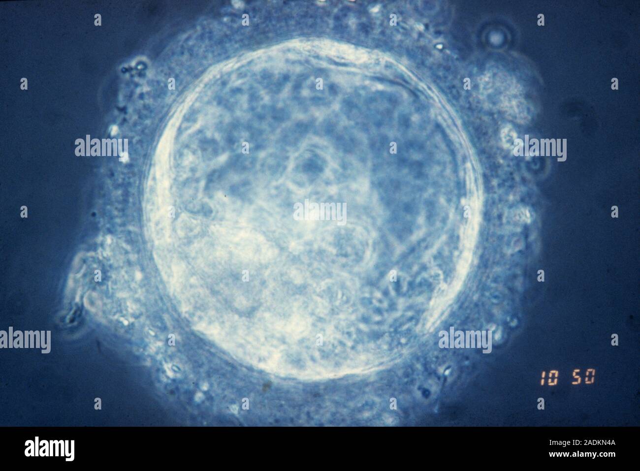 Light micrograph of a human blastocyst, an early stage of embryonic ...