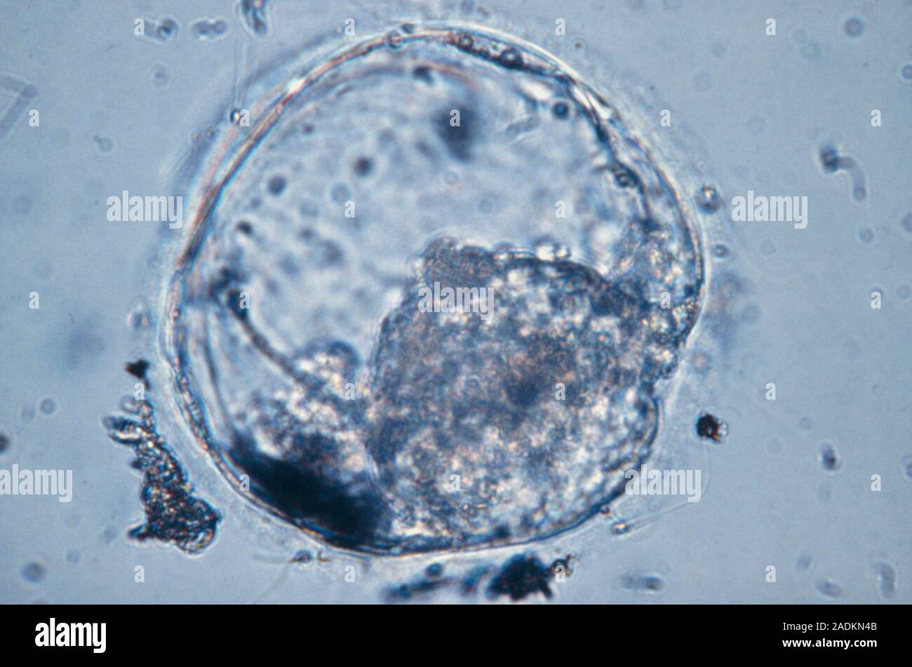 Light micrograph (Kohler illumination) of a human blastocyst, an early ...