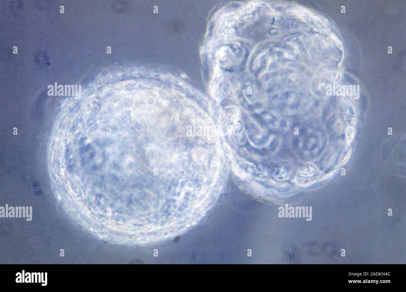 Light micrograph showing a hatching blastocyst, a six days-old human ...