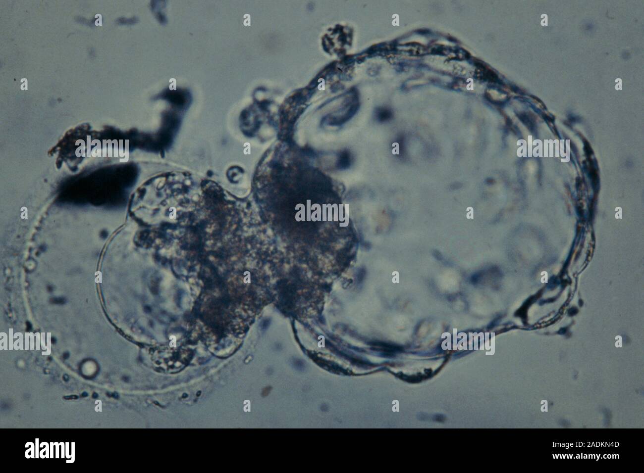 Light micrograph showing a hatching blastocyst, a six days-old human ...