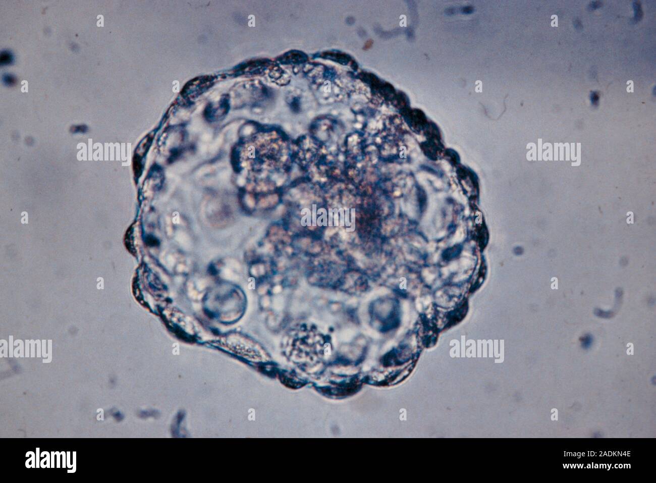 Light micrograph showing a human blastocyst, the pre-embryo six days ...