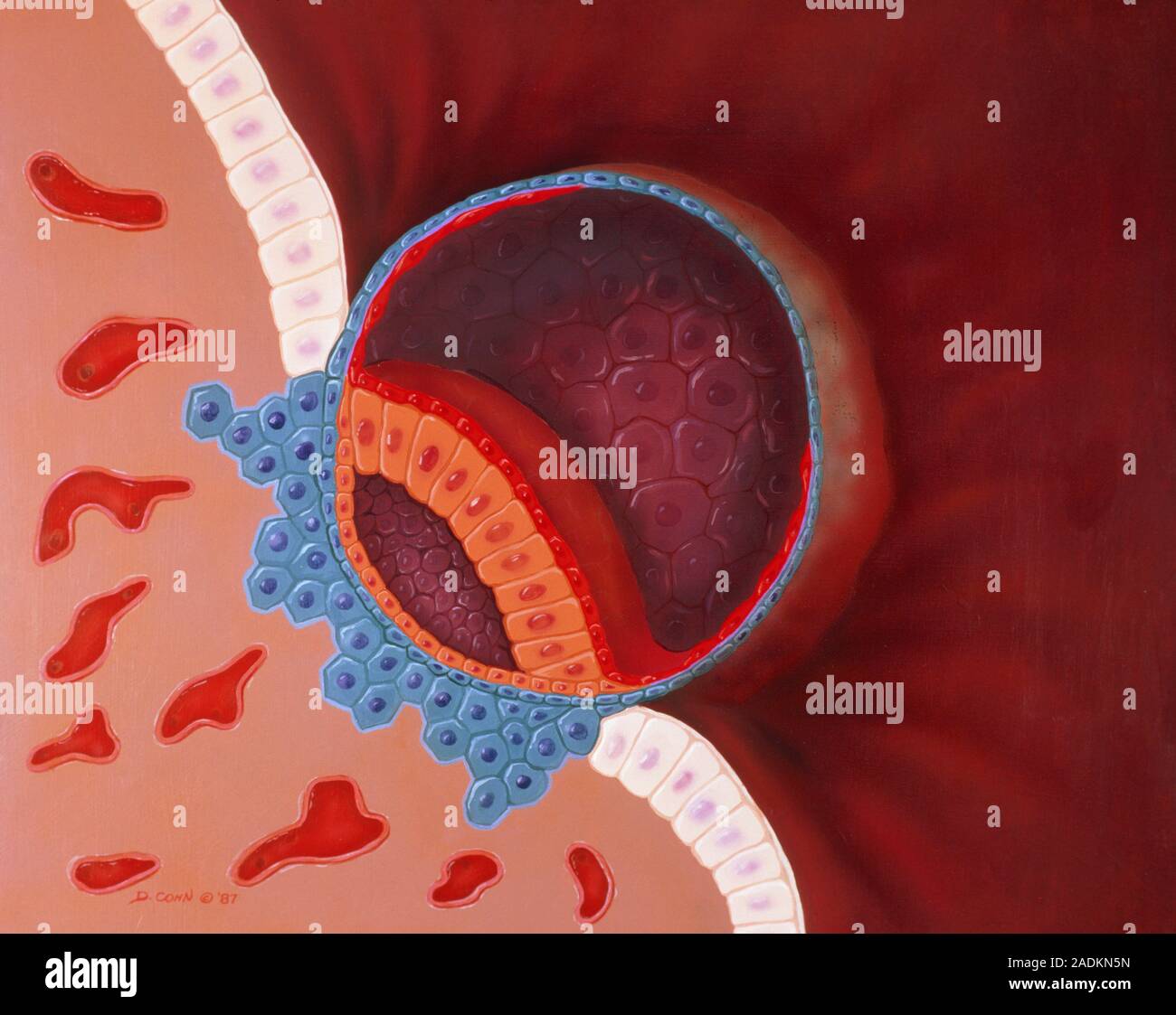 Human blastocyst. Illustration of a human embryo 7-8 days after ...