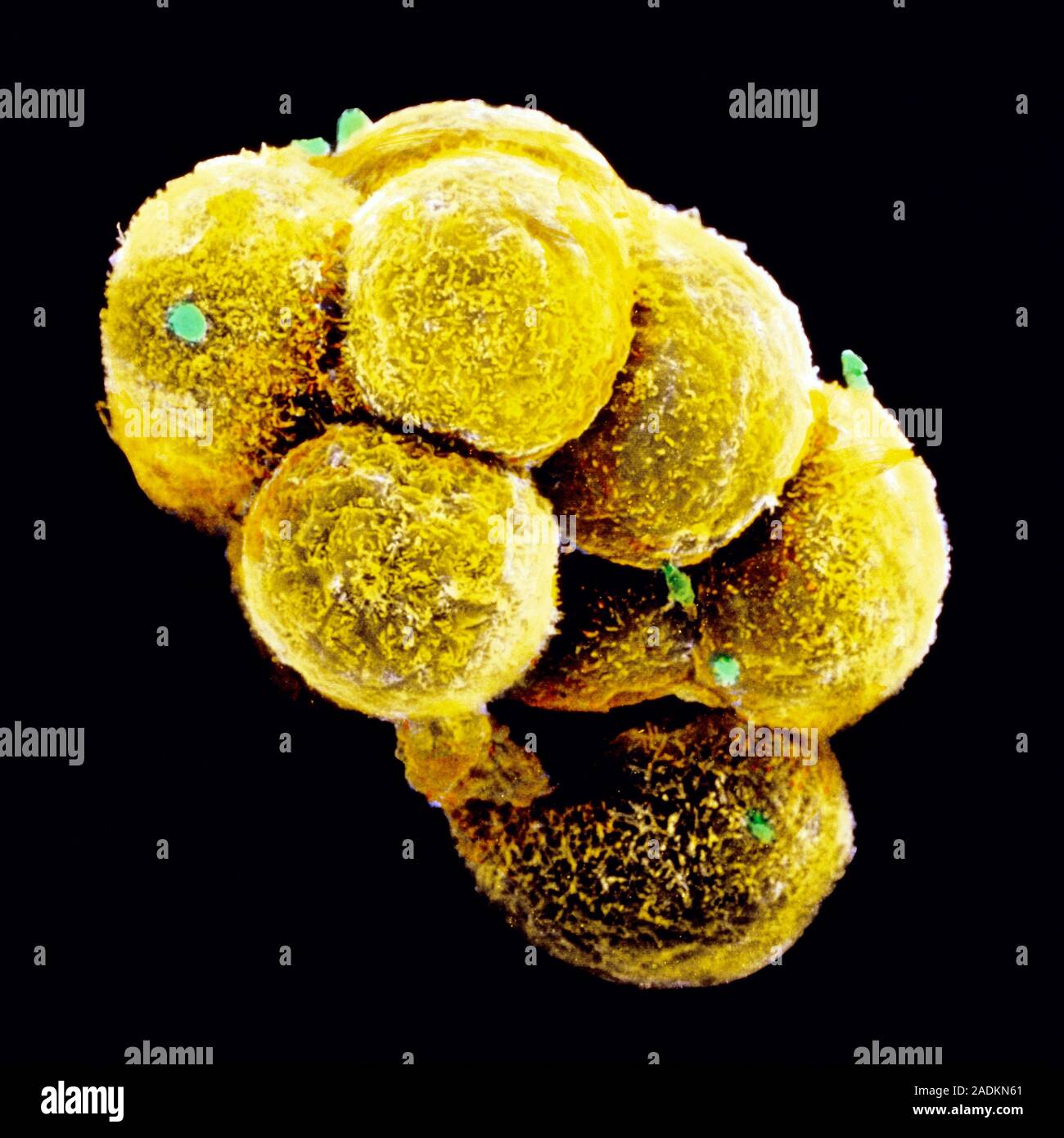 Embryo development. Coloured scanning electron micrograph of an embryo ...
