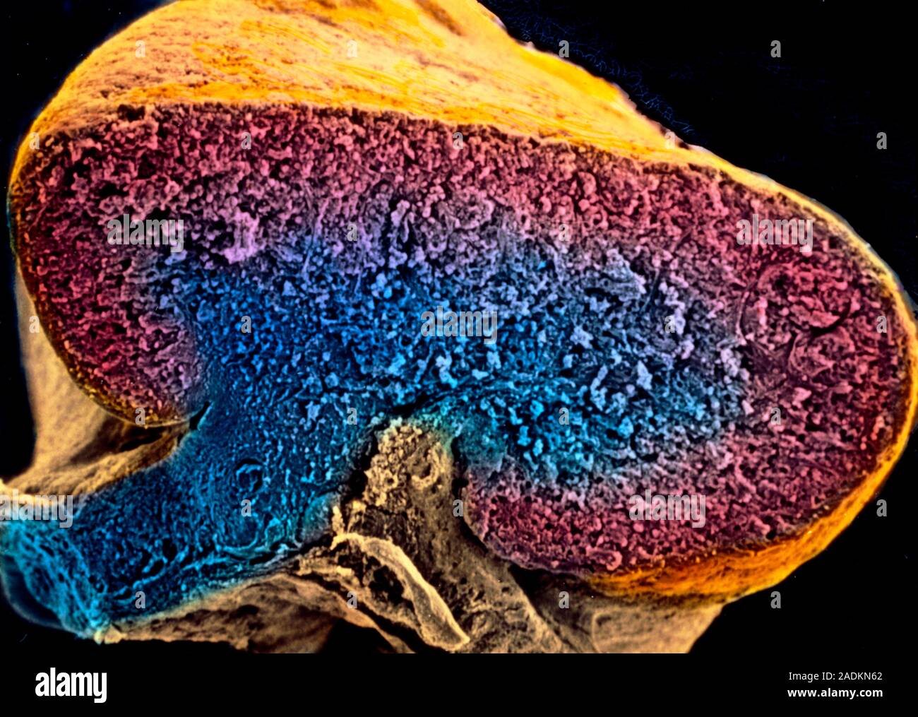 Embryo. Coloured scanning electron micrograph of a sectioned human ...