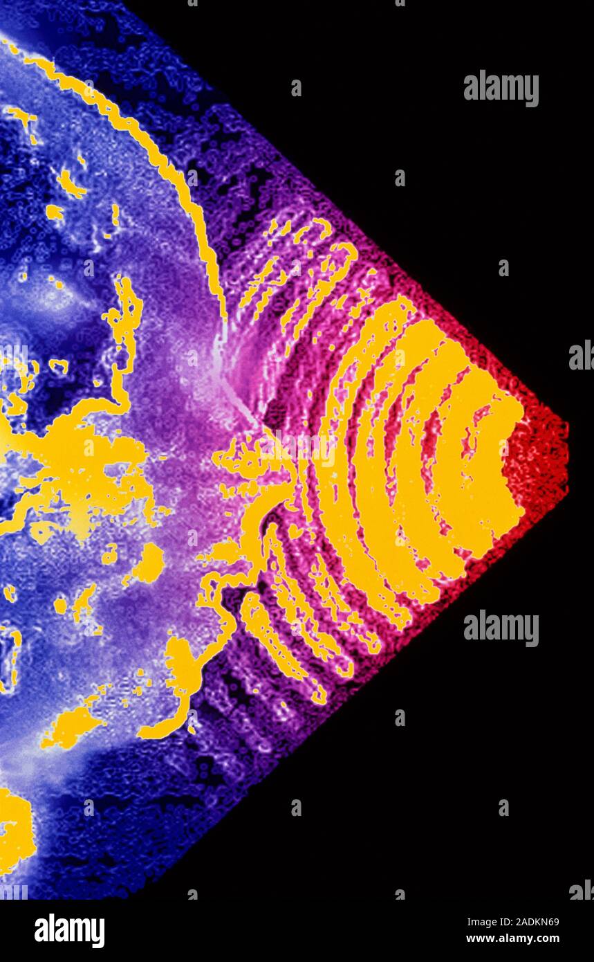 Ultrasound image of foetus. Computer graphics illustration of an ...