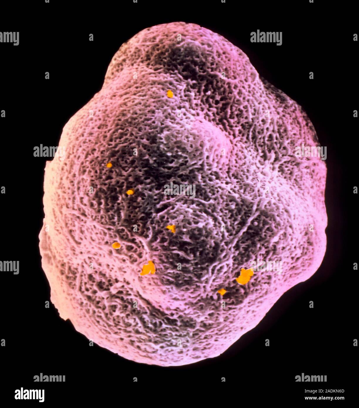 Human morula. Coloured Scanning Electron Micrograph (SEM) of a human ...