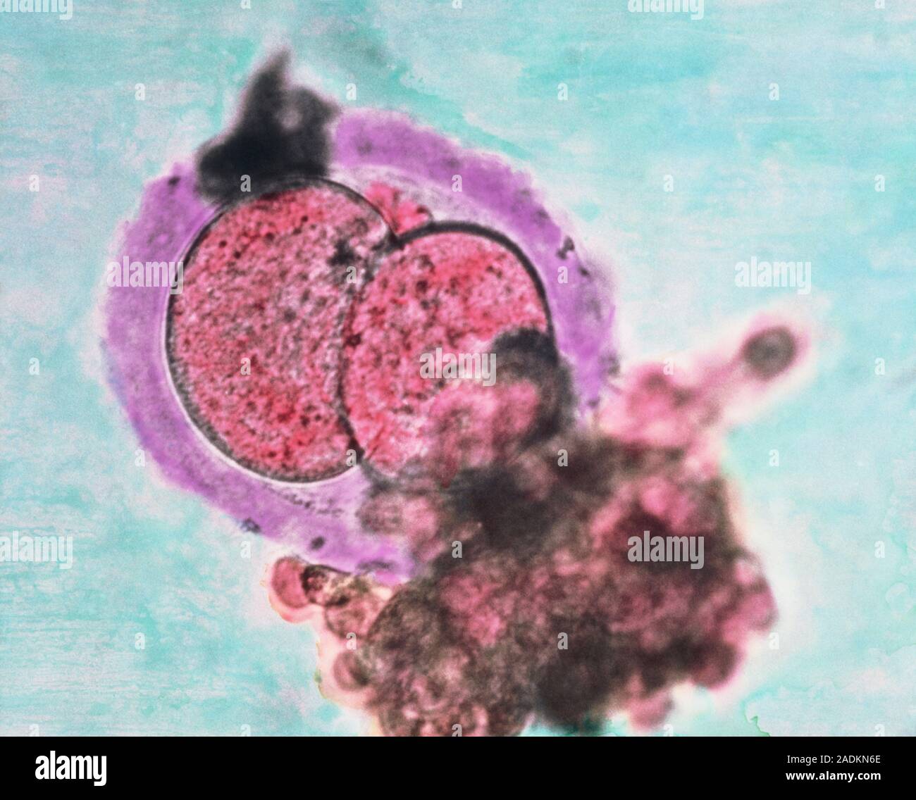 Two-cell embryo. Coloured light micrograph of a human embryo at the 2 ...