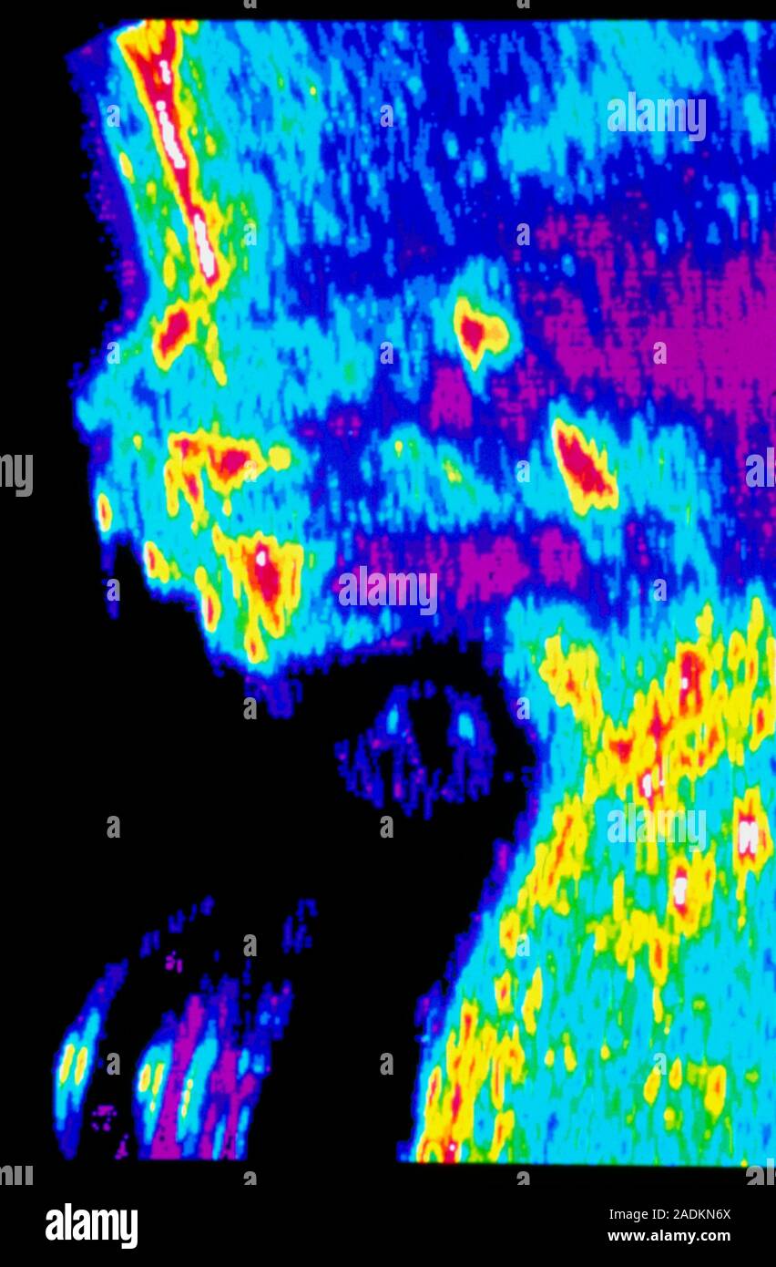 Seven-month-old foetus. Coloured ultrasound scan of a seven-month-old ...