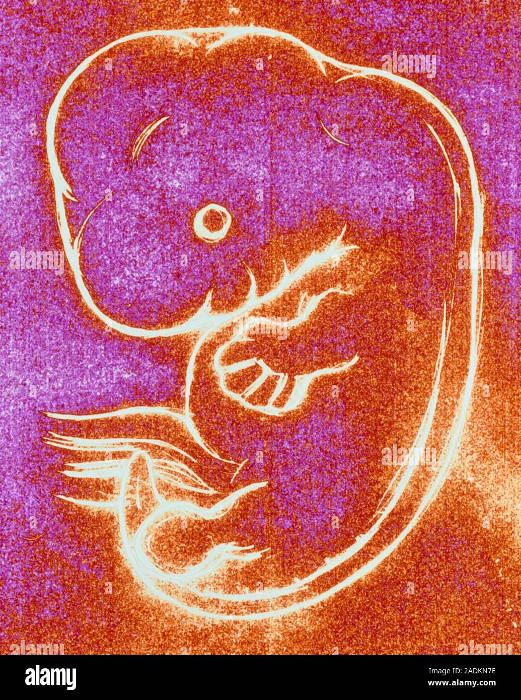 Embryo. Artwork of a seven-week old human embryo. At this stage of ...