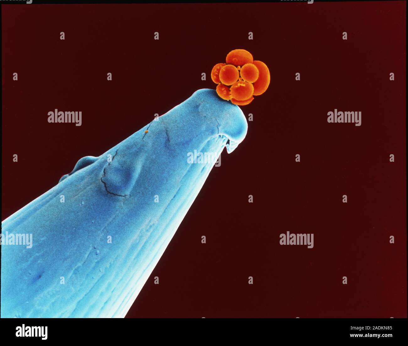 Human embryo. Coloured scanning electron micrograph (SEM) of a human ...