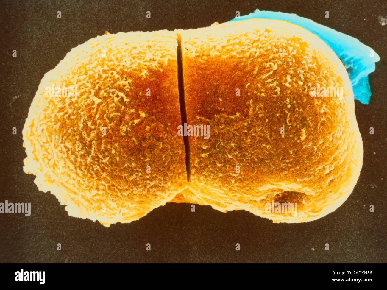 Two-cell embryo. Coloured scanning electron micrograph of the ...