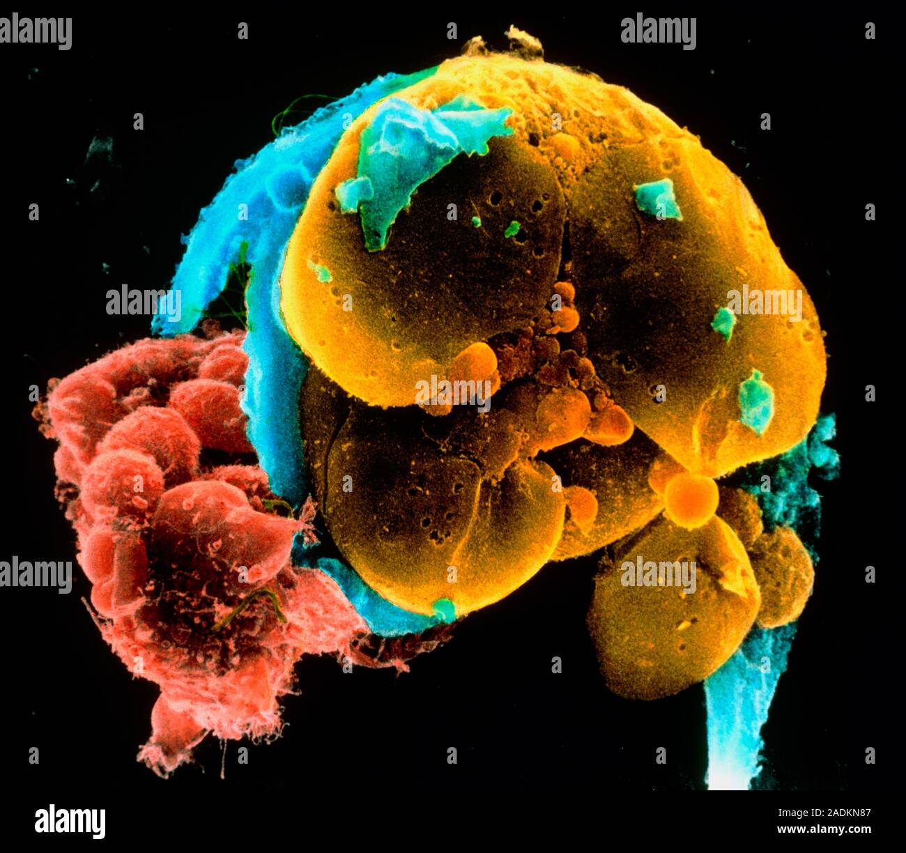 6-8 cell embryo. Coloured scanning electron micrograph of layers of a 6 ...