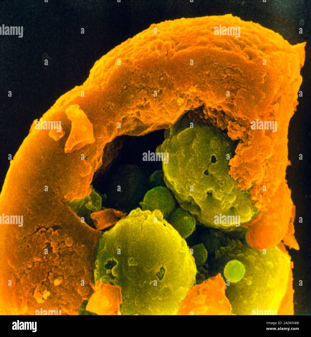 Aborting embryo. Coloured scanning electron micrograph of an aborting 6 ...