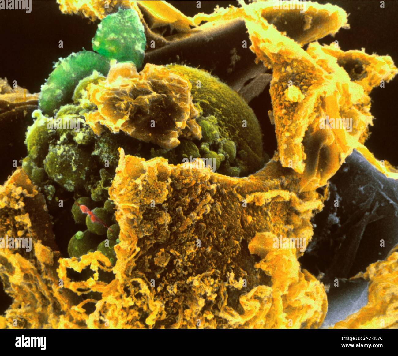 Aborting embryo. Coloured scanning electron micrograph (SEM) of an ...