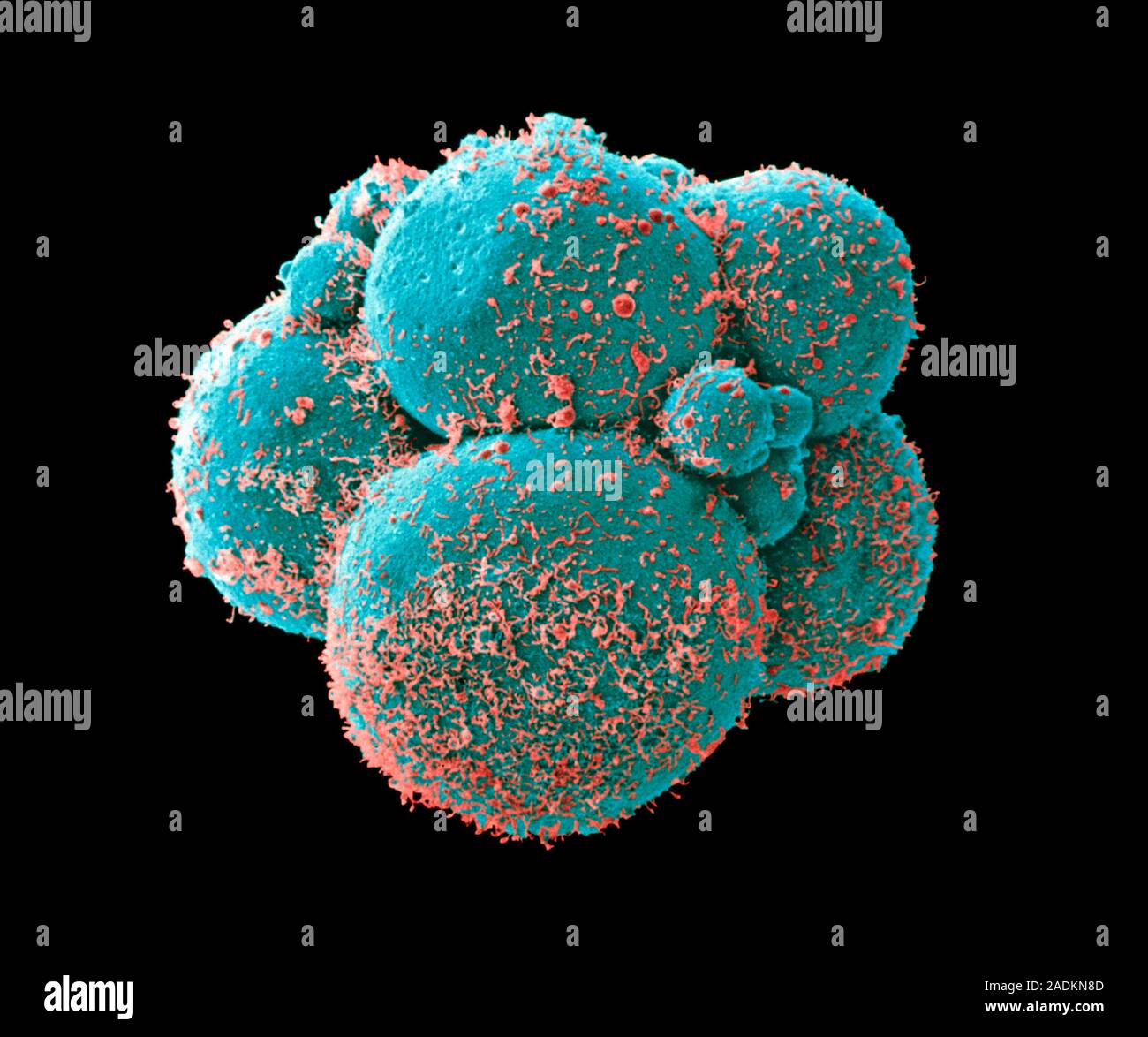 Eight-cell embryo. Coloured scanning electron micrograph (SEM) of a ...