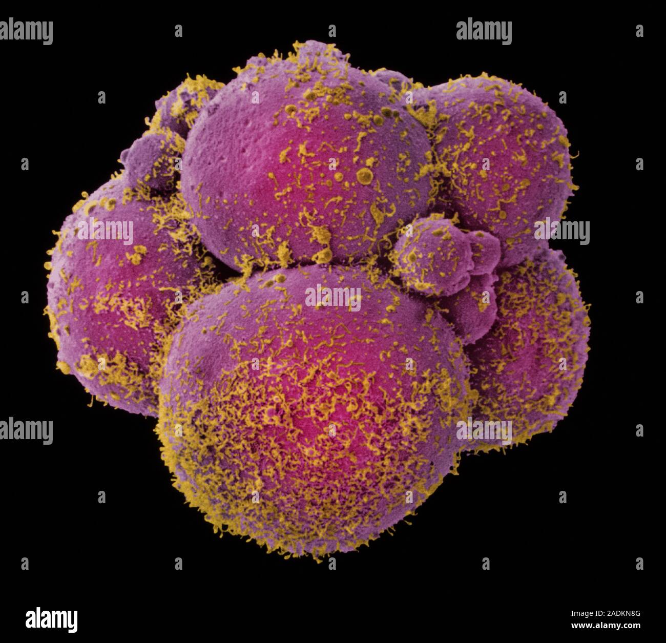 Eight-cell embryo. Coloured scanning electron micrograph (SEM) of a ...
