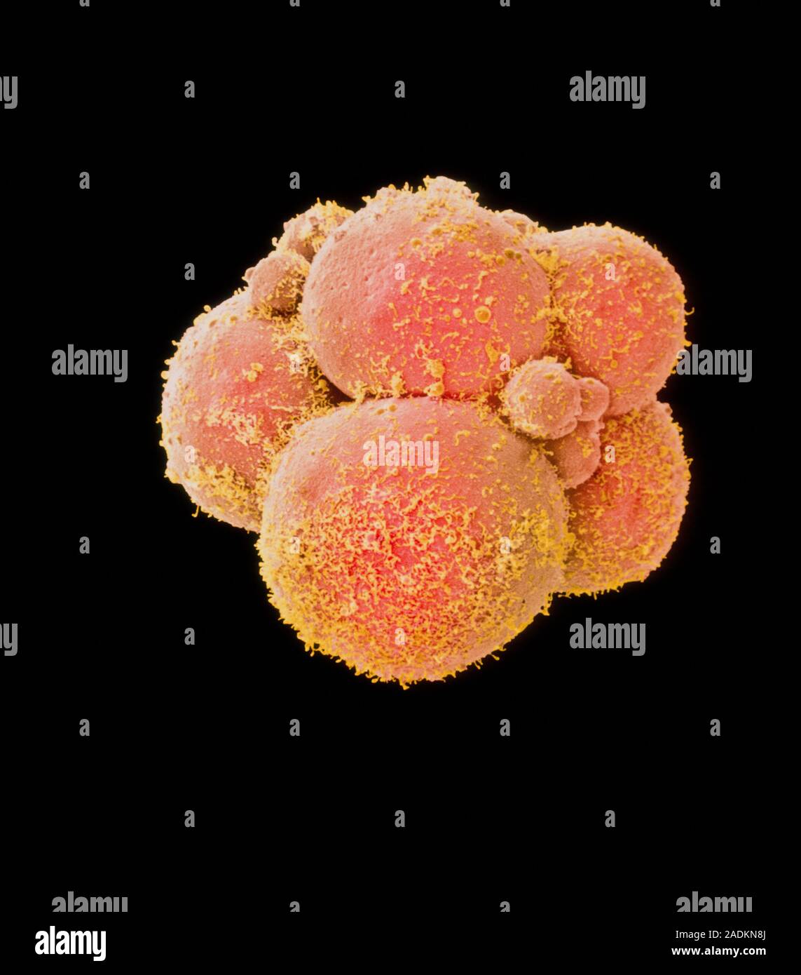 Eight-cell embryo. Coloured scanning electron micrograph (SEM) of a ...