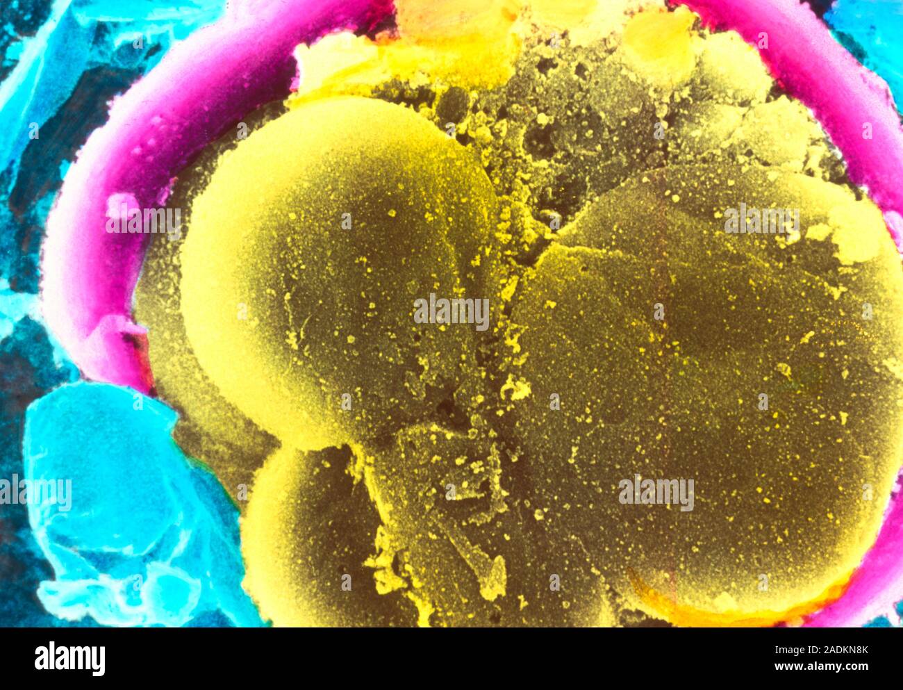 4-6 cell embryo. Coloured scanning electron micrograph (SEM) of layers ...