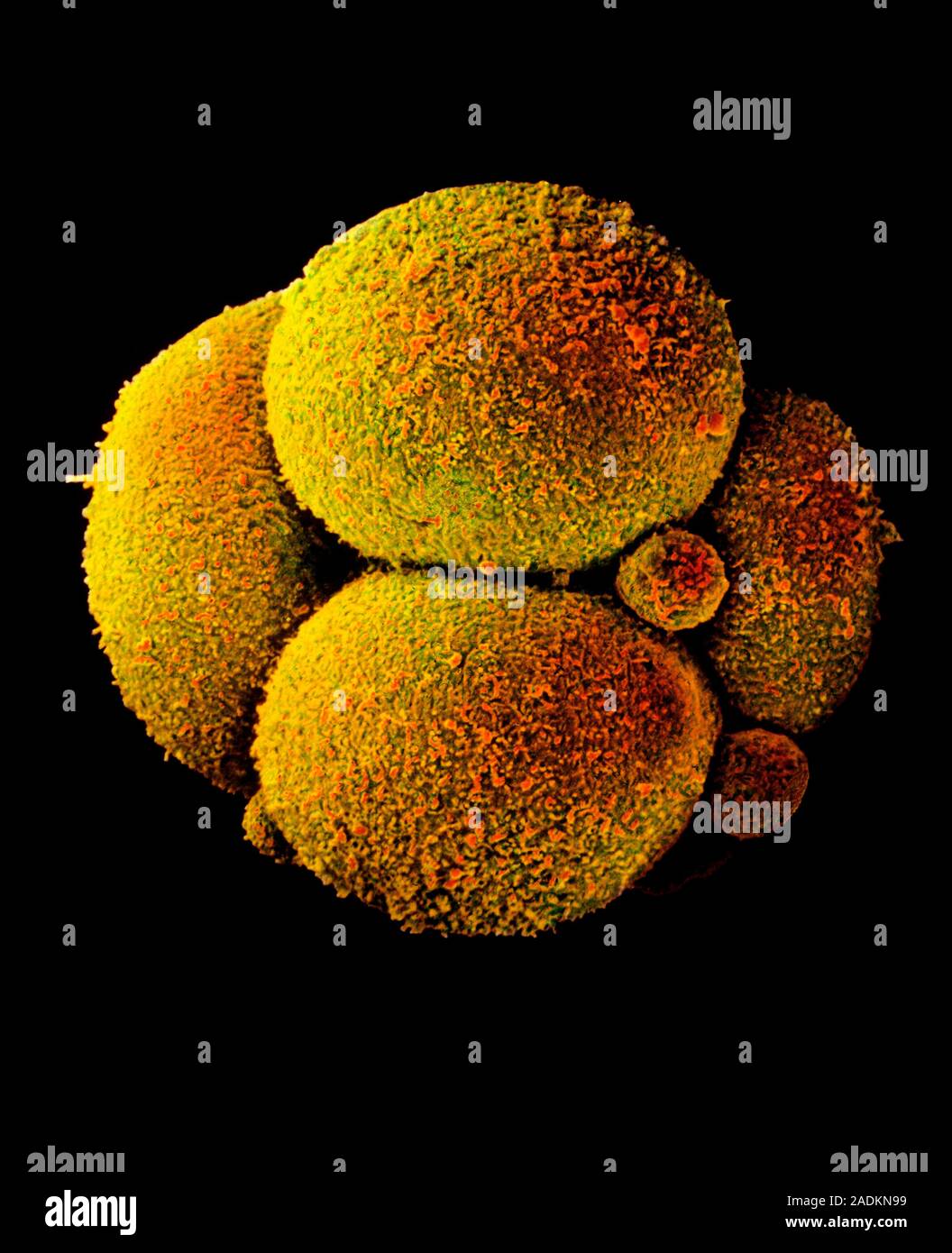 Four-cell embryo. Coloured scanning electron micrograph (SEM) of a ...