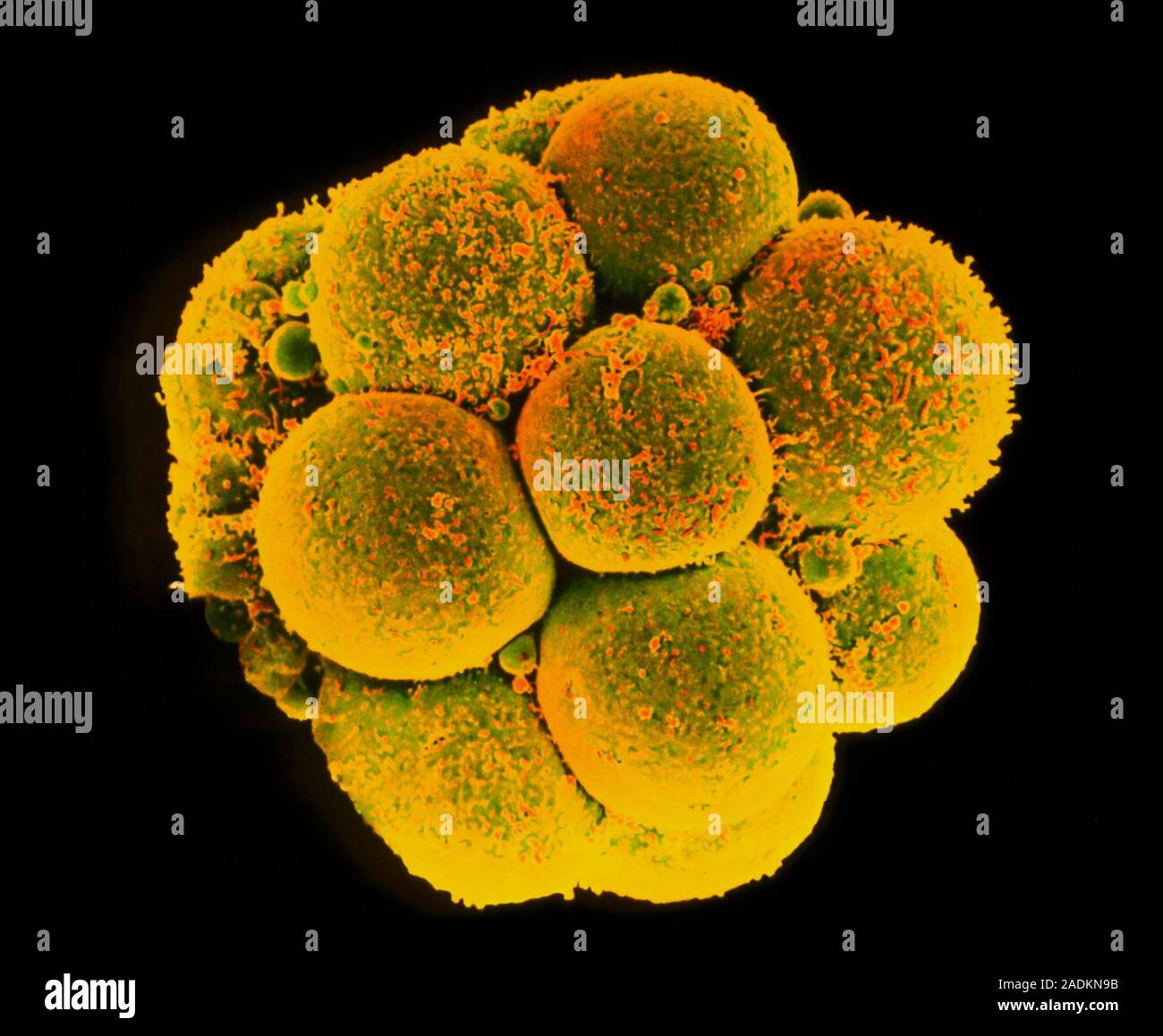 Sixteen-cell embryo. Coloured scanning electron micrograph (SEM) of a ...