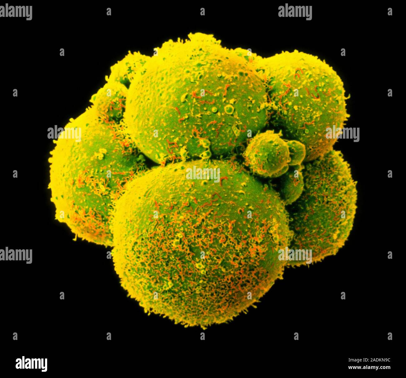 Eight-cell embryo. Coloured scanning electron micrograph (SEM) of a ...