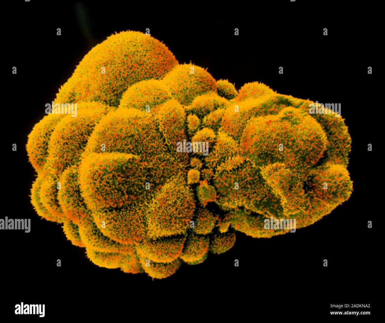 Hatched blastocyst embryo. Coloured scanning electron micrograph (SEM ...