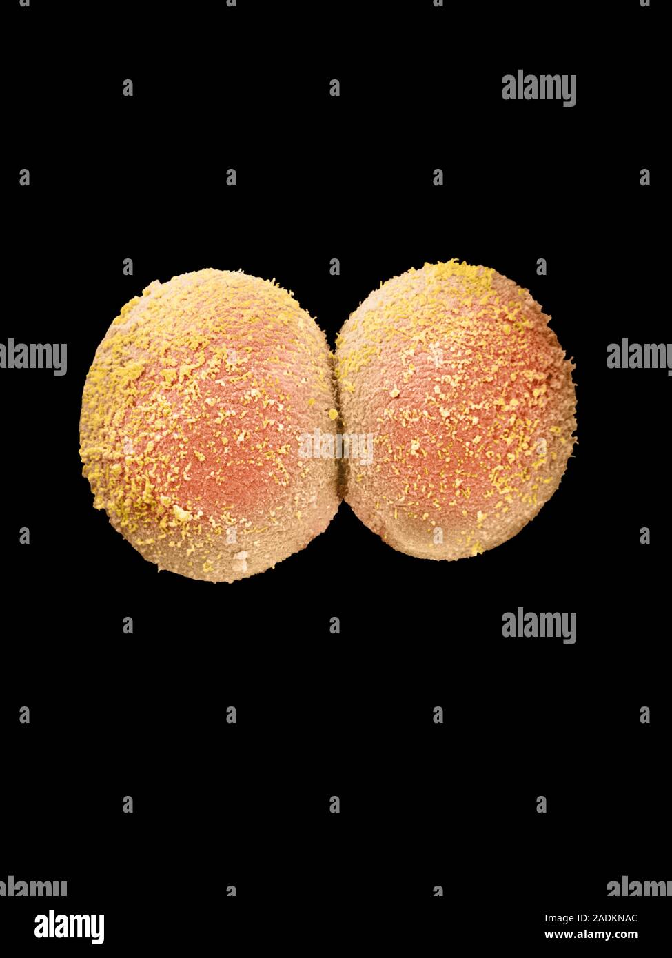 Two-cell embryo. Coloured scanning electron micrograph (SEM) of a human ...