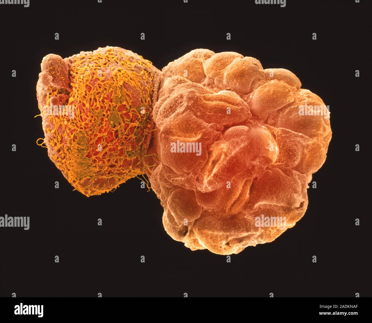 Hatching Blastocyst Embryo Coloured Scanning Electron Micrograph Sem